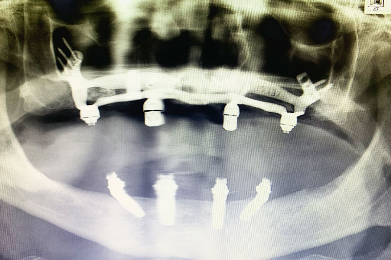 Custom Life | CPMH Digital